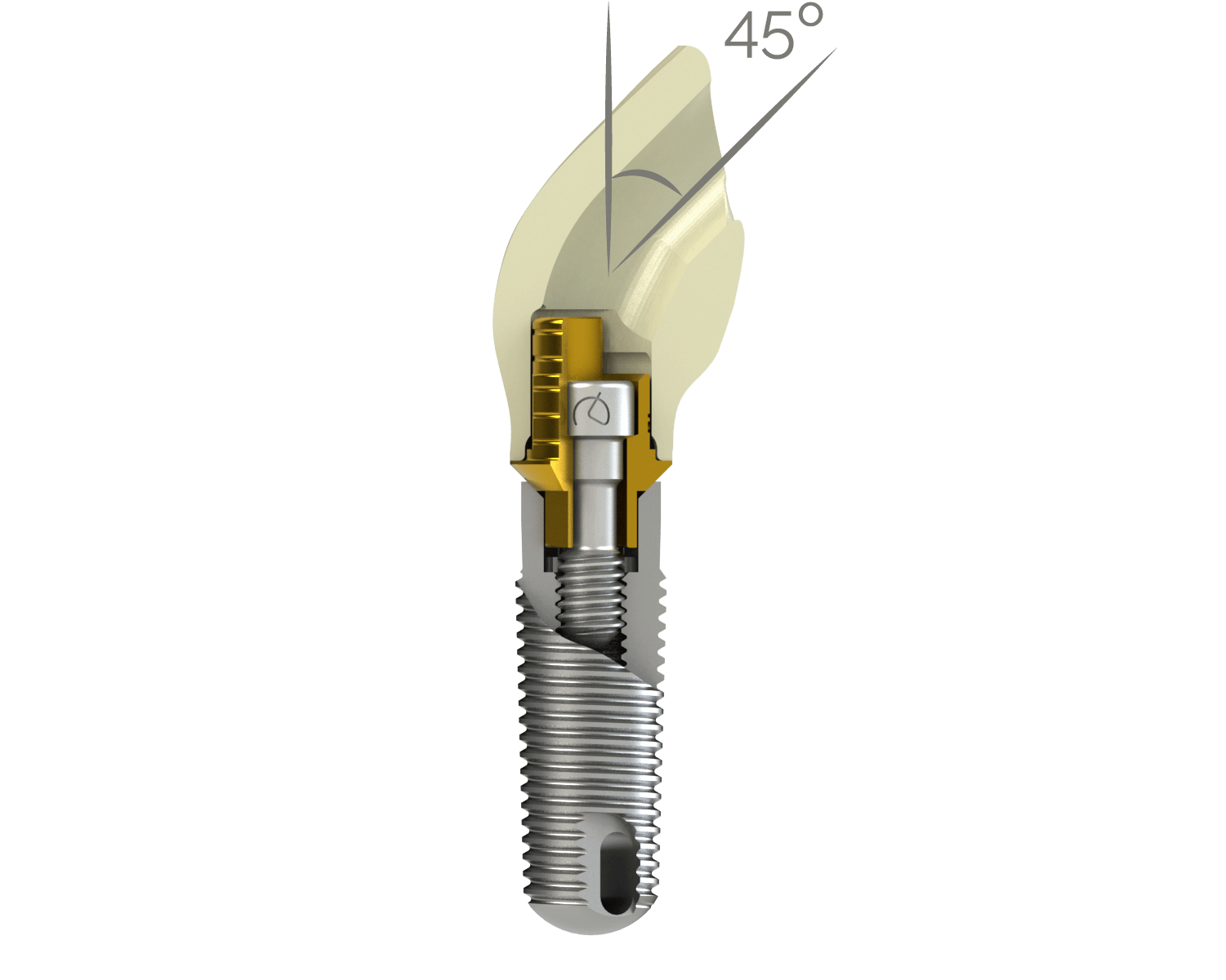 Dynamic TiBase | Dynamic Abutment Solutions